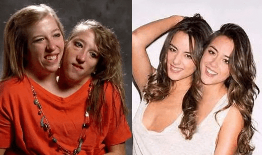 Abby And Brittany Hensel Are Abby And Brittany Hensel Married United